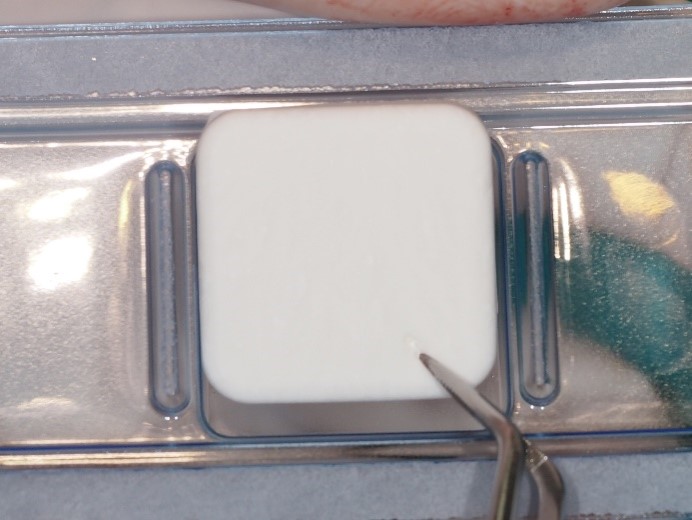 RESODONT PARASORB® Fleece - Simple procedures - RAVIV MEDICAL